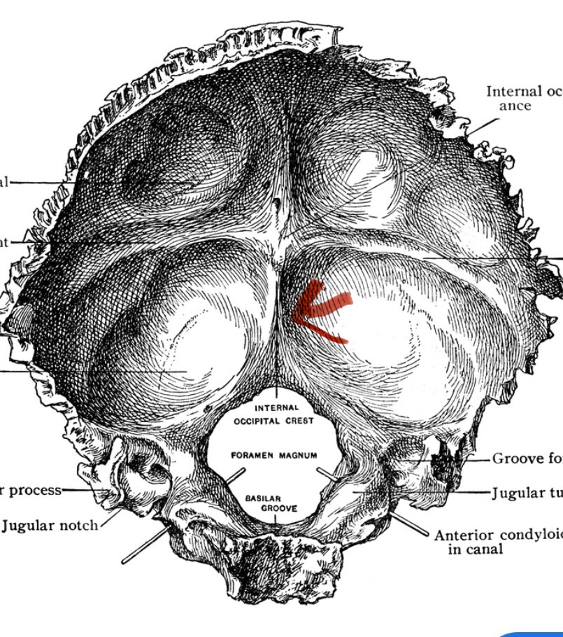 SOMETIMES YOU HAVE TO CONNECT THE SKULL TO THE NECK | NSPC Brain ...